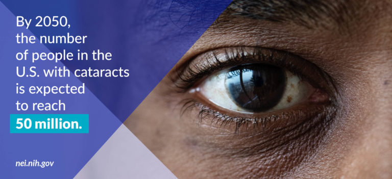 Eye Surgery: From Cataract to LASIK – Types, Recovery, and Risks | Made ...